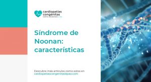 Síndrome de Noonan: características - Cardiopatías Congénitas La Paz