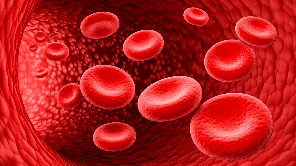 Truncus arterioso: qué es - Cardiopatías Congénitas La Paz