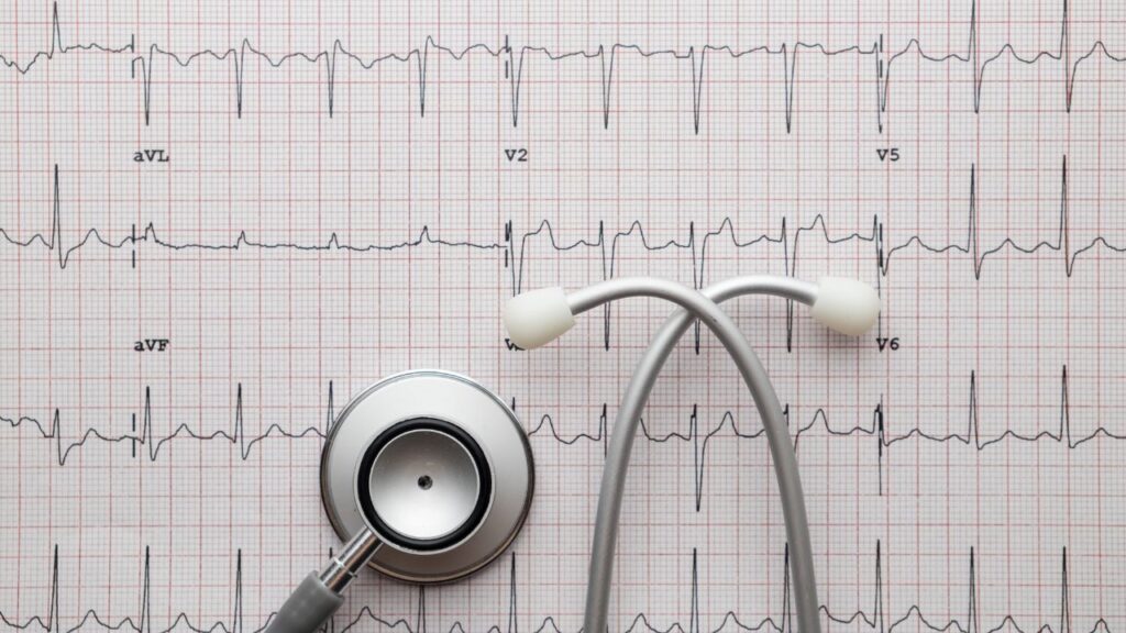 Qué es un ECG de 12 derivaciones - Cardiopatías Congénitas La Paz