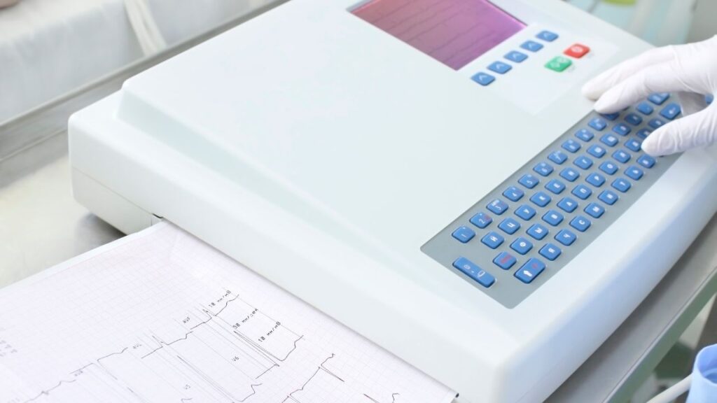 Qué es un ECG de 12 derivaciones - Cardiopatías Congénitas La Paz