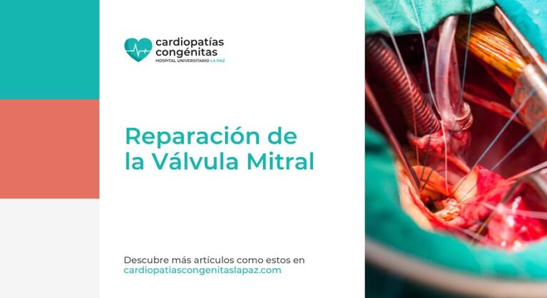 Reparación De La Válvula Mitral Cardiopatías Congénitas La Paz